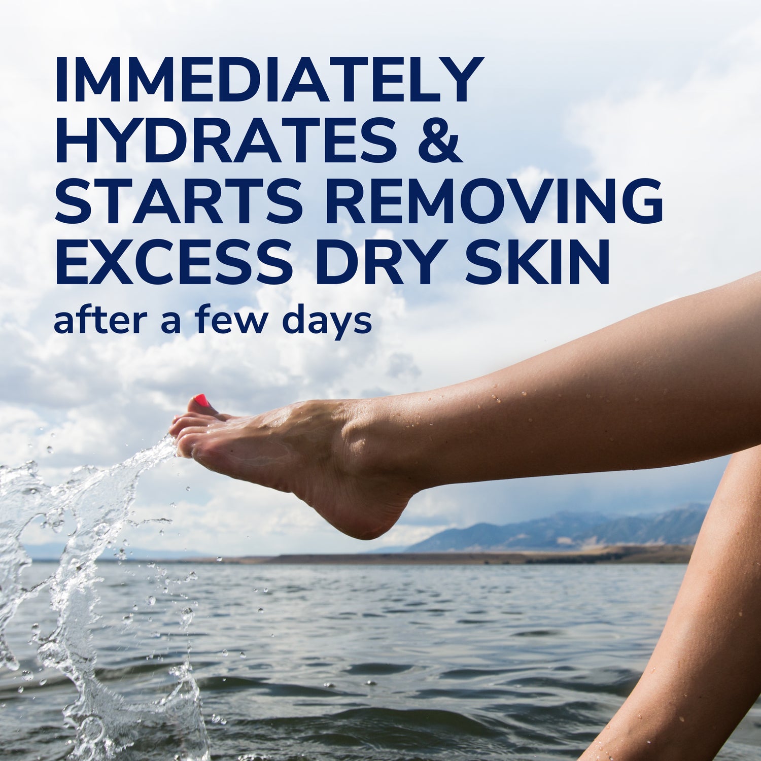 Dry, Flaky Skin Remover Ultra-Exfoliating Foot Lotion – DrScholls