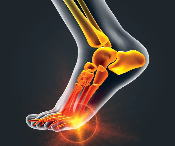 Ball of Foot Metatarsal Pain Relief Pad – DrScholls